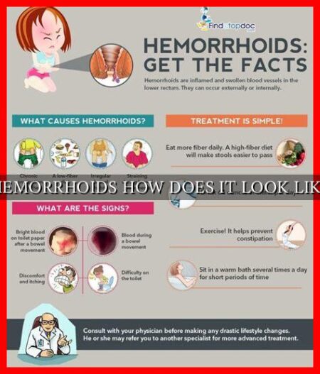 HEMORRHOIDS HOW DOES IT LOOK LIKE - Wadaef