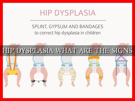 HIP DYSPLASIA WHAT ARE THE SIGNS - Wadaef