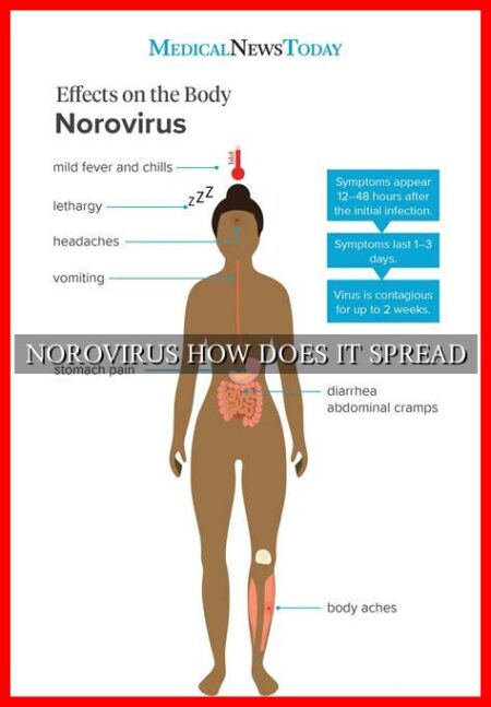 NOROVIRUS HOW DOES IT SPREAD - Wadaef NOROVIRUS HOW DOES IT SPREAD - Wadaef