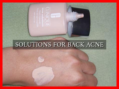 SOLUTIONS FOR BACK ACNE - Wadaef
